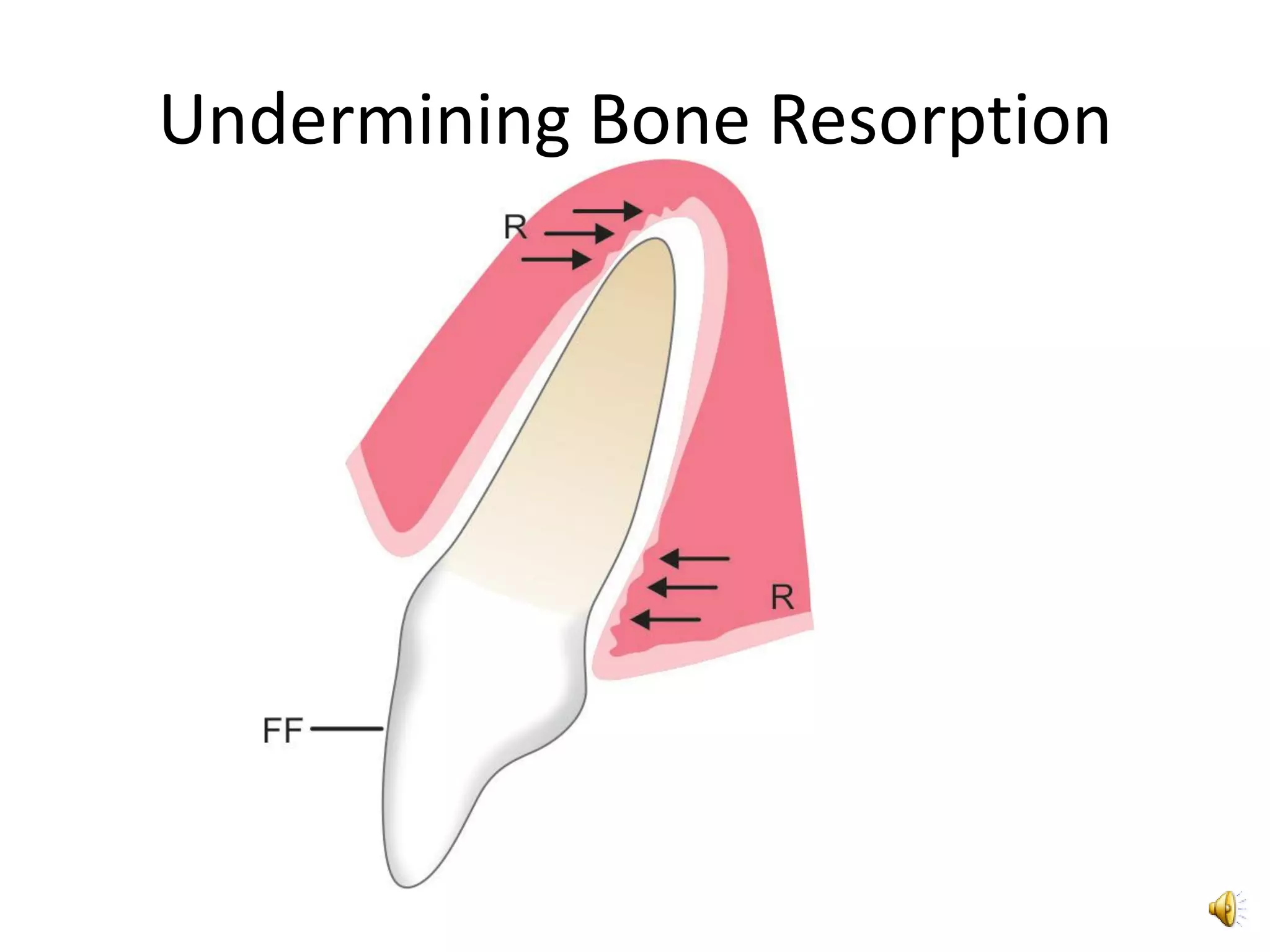_7-Tissue Changes in Orthodontic Tooth Movement.pdf