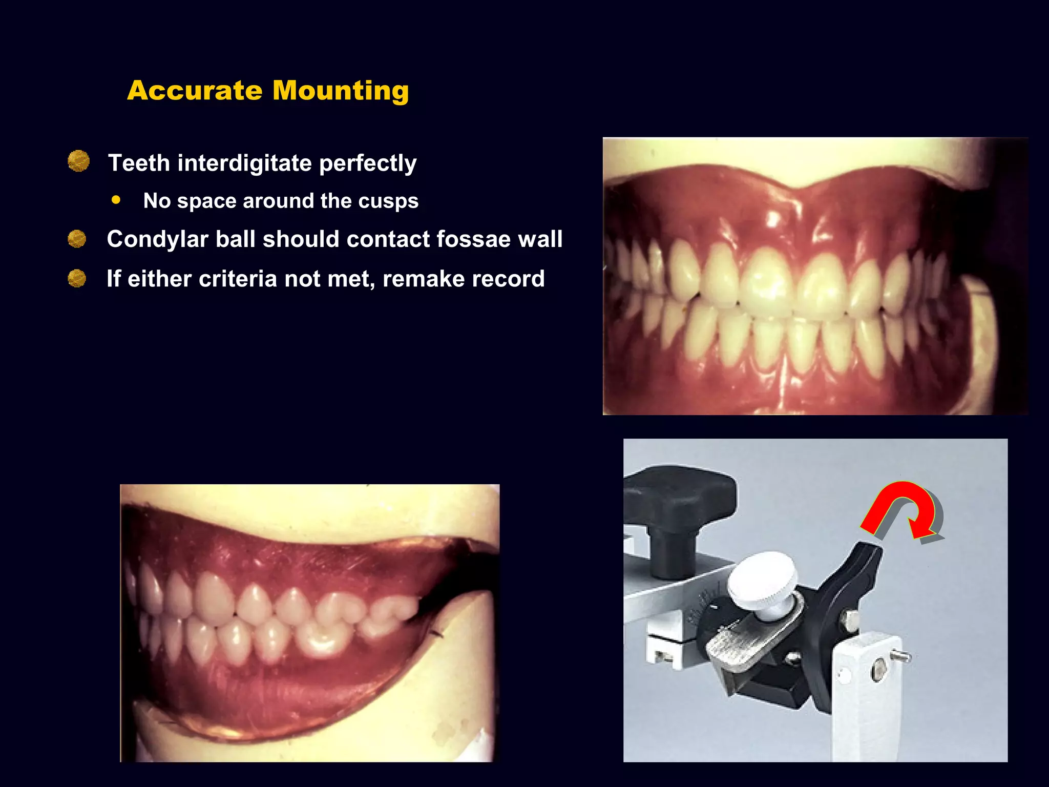 7 try-in of the wax trial complete denture | PPT