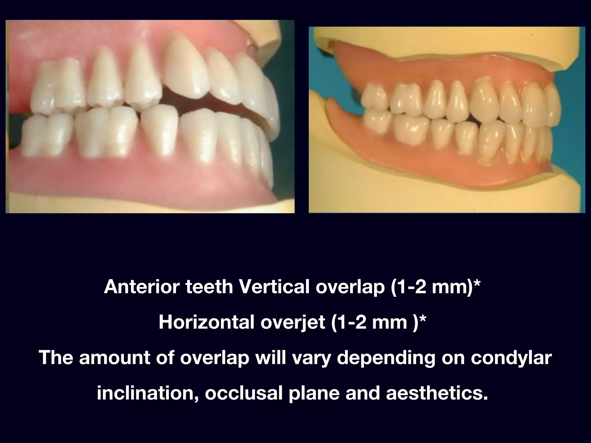 7 try-in of the wax trial complete denture | PPT