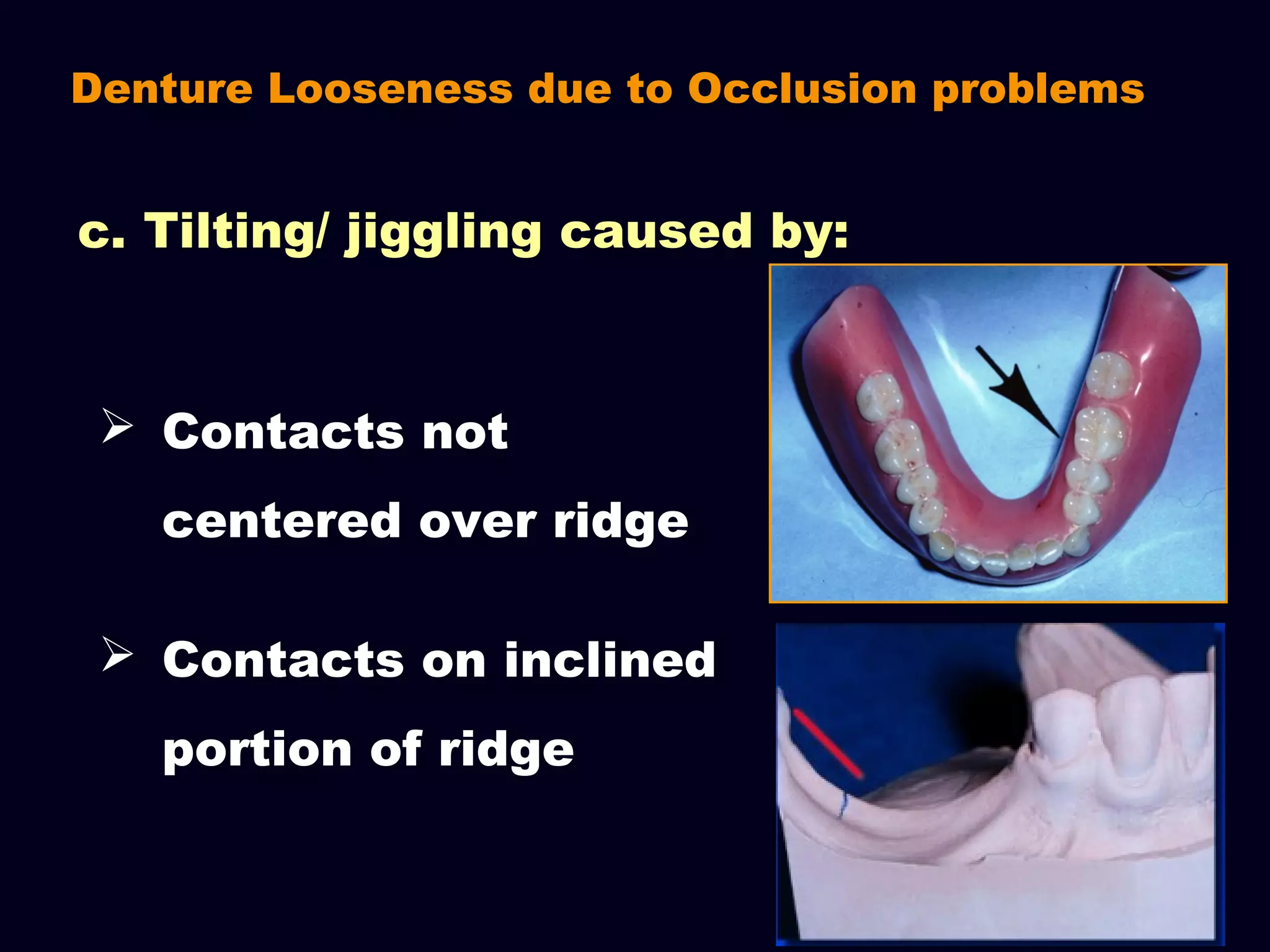 7 try-in of the wax trial complete denture | PPT