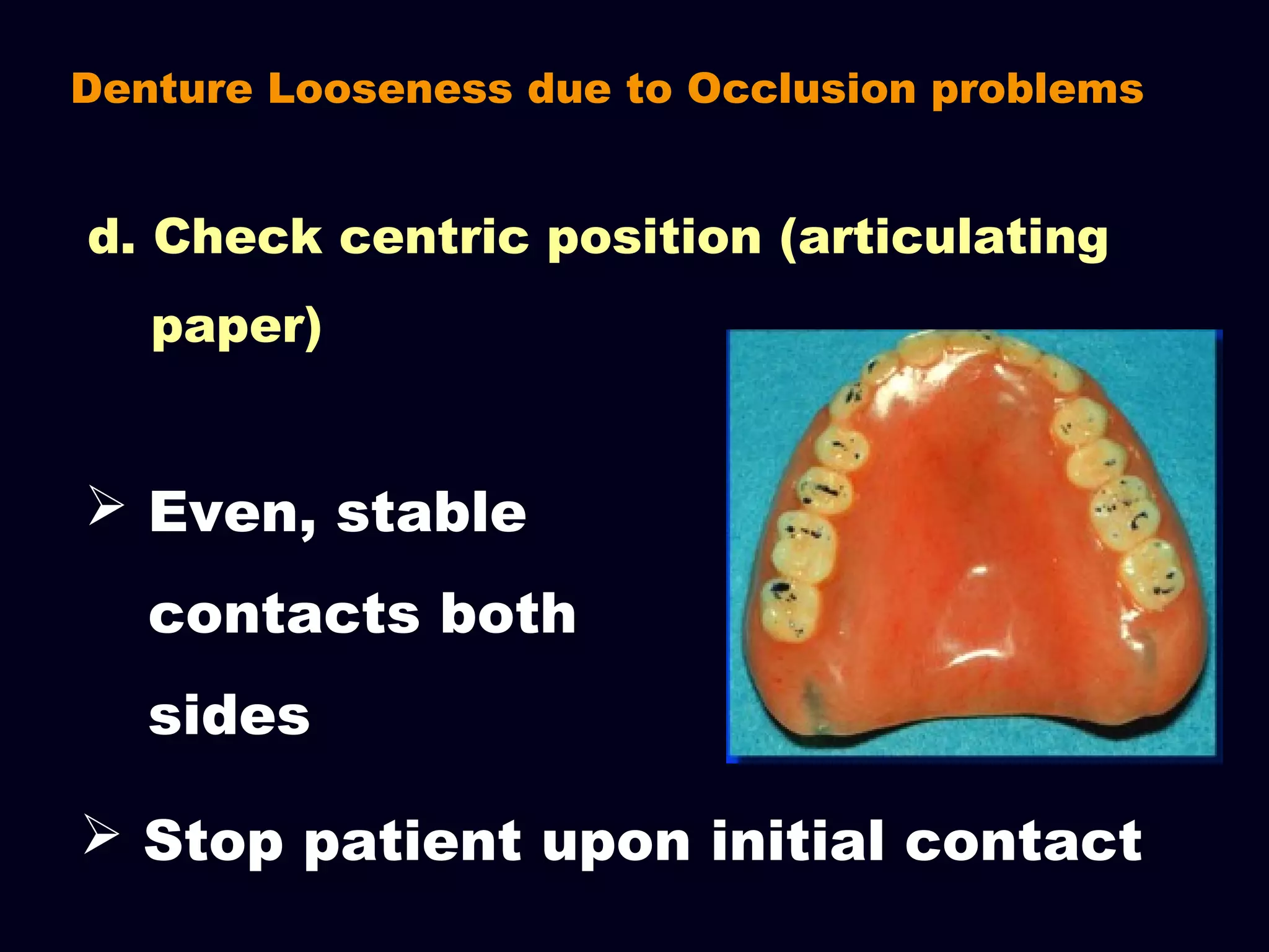 7 try-in of the wax trial complete denture | PPT
