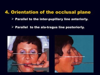 7 try-in of the wax trial complete denture | PPT