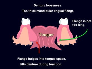 7 try-in of the wax trial complete denture | PPT