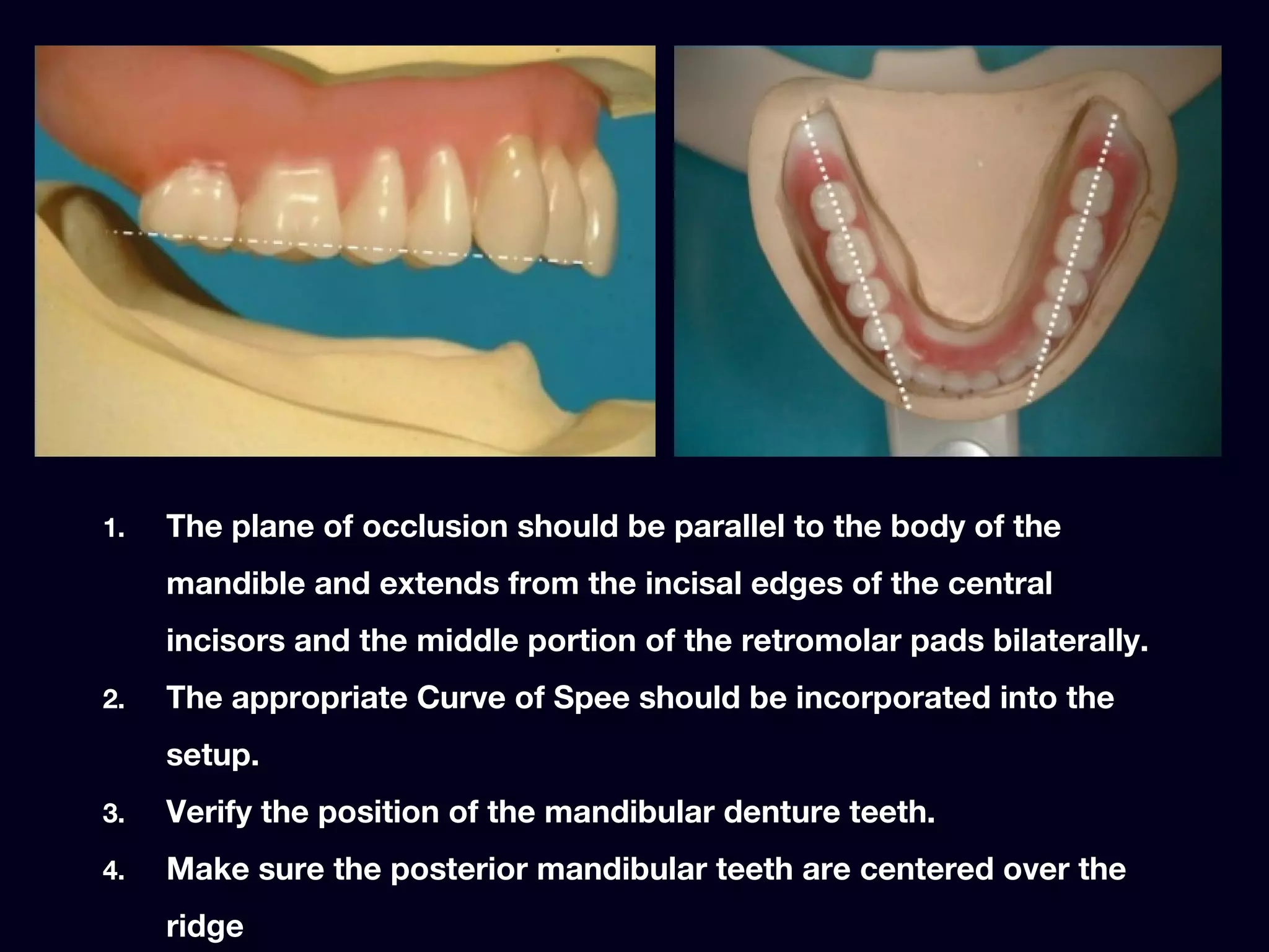7 try-in of the wax trial complete denture | PPT