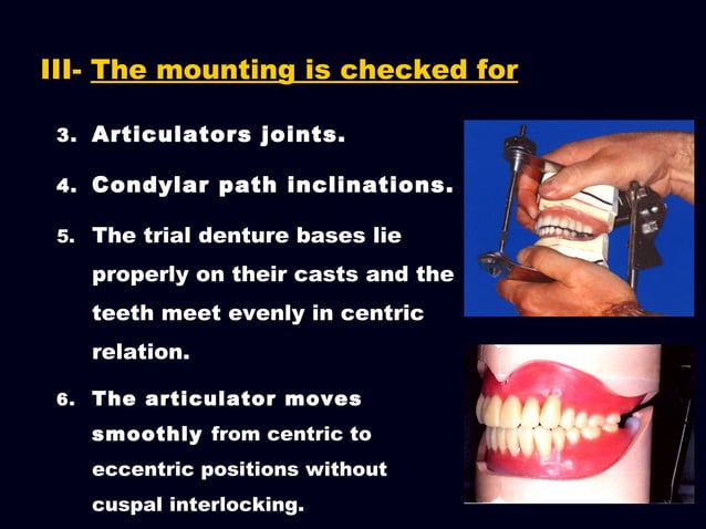 7 try-in of the wax trial complete denture | PPT | Dental Health ...