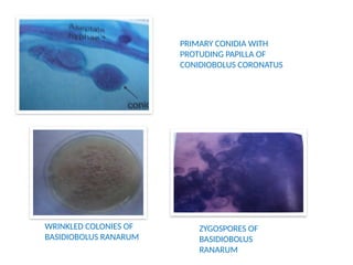 Lobomycosis, Rhinosporodiosis and Subcutaneous zygomycosis | PPT