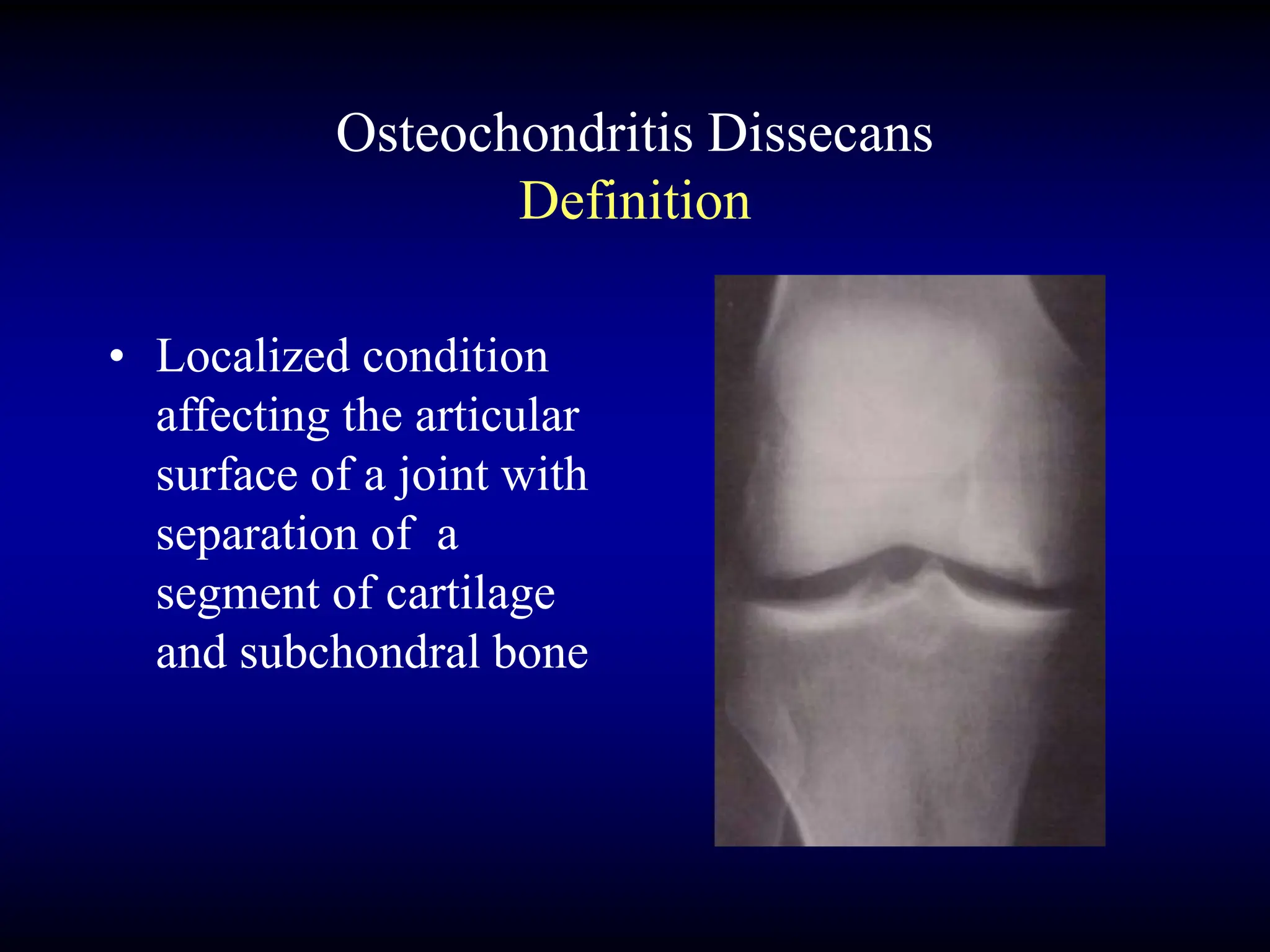 Osteocondritis disecante de rodilla juvenil | PPT