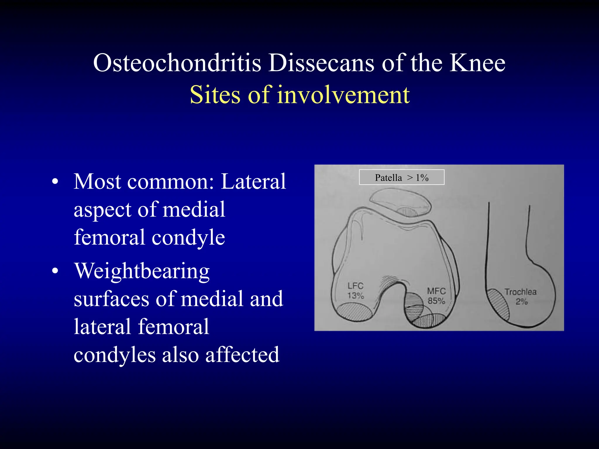 Osteocondritis disecante de rodilla juvenil | PPT