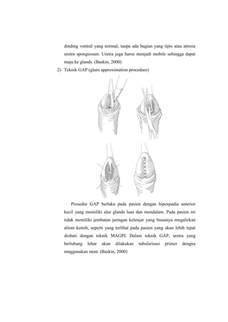 70233922-HIPOSPADIA.doc