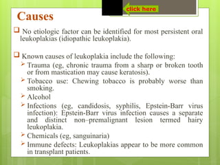 Oral Leukoplakia Pathophysiology-Clinical Picture-Causes-Surgical Care ...