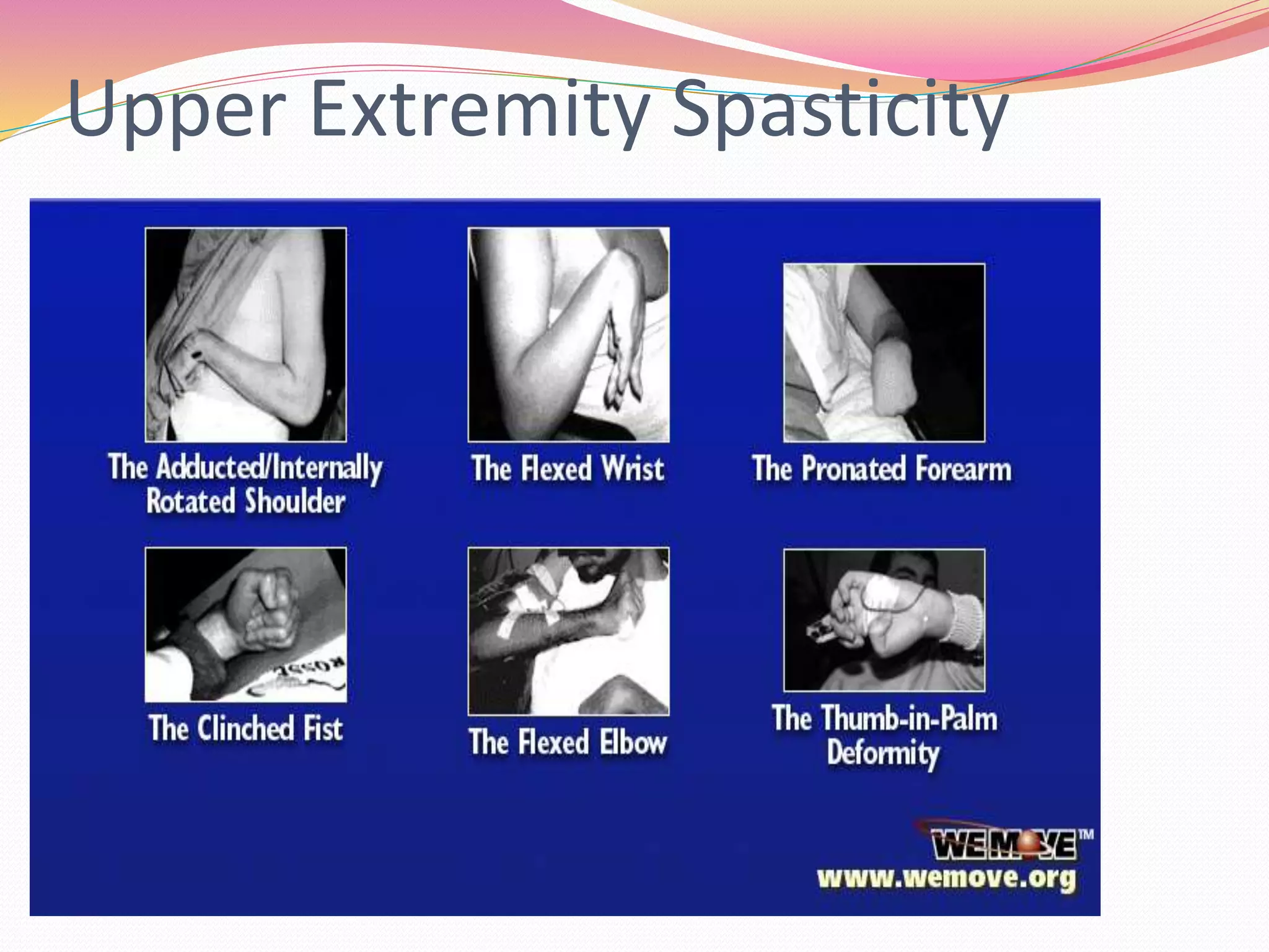 SPASTICITY | PPTX