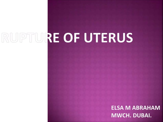 Elsa Presentation | PPT