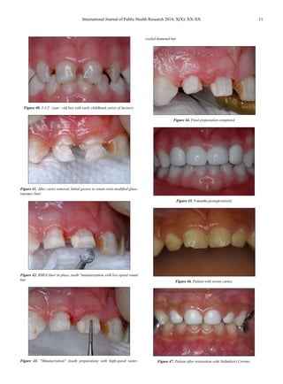 Anterior dental esthetics in primary teeth | PDF