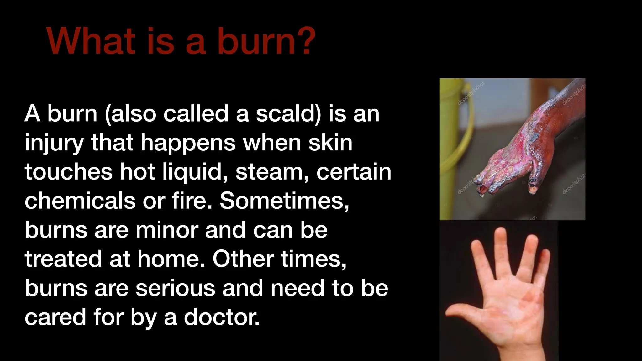 Healthcare-Associated_Burn_Wound_Infections.pdf