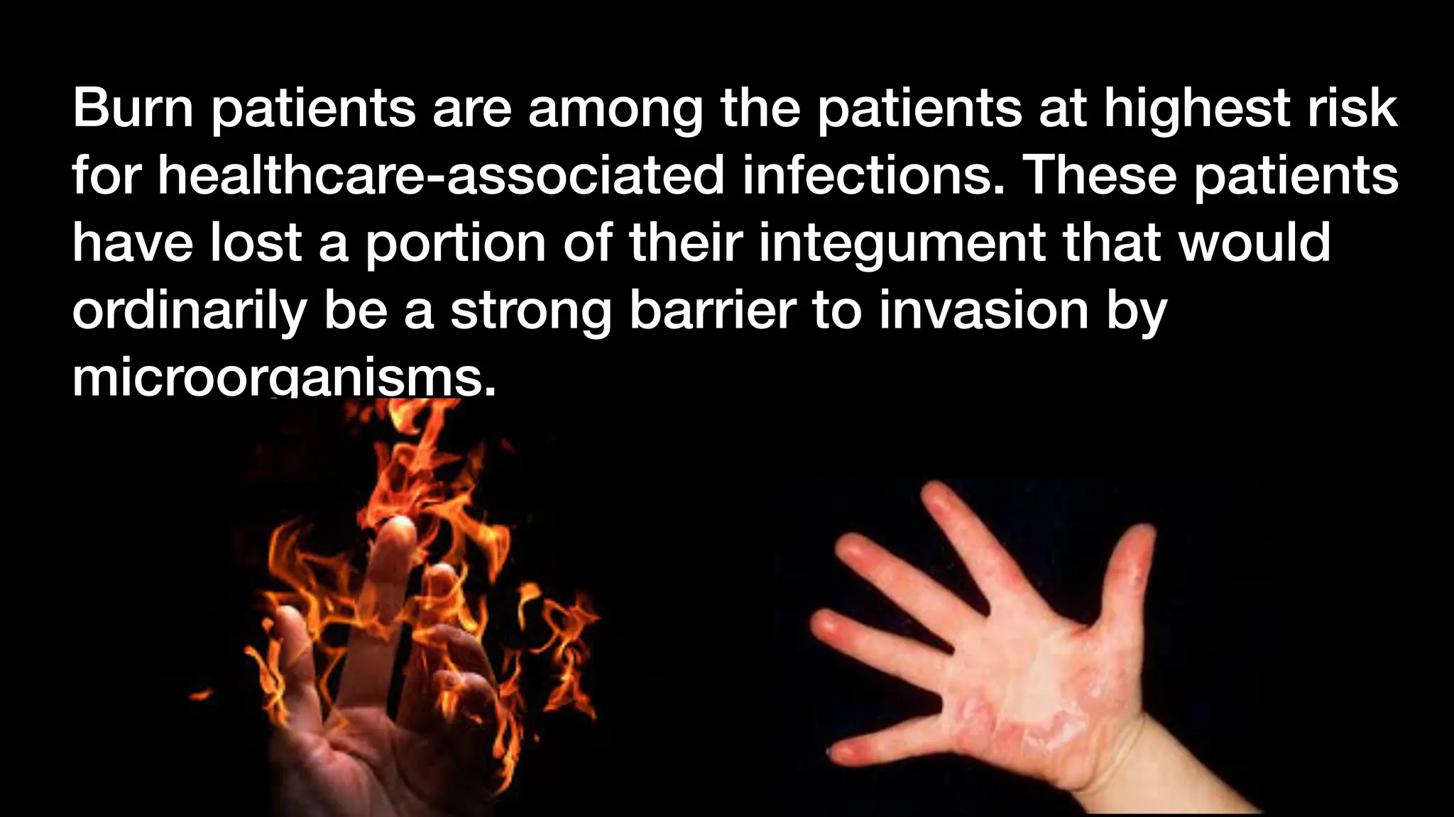 Healthcare-Associated_Burn_Wound_Infections.pdf