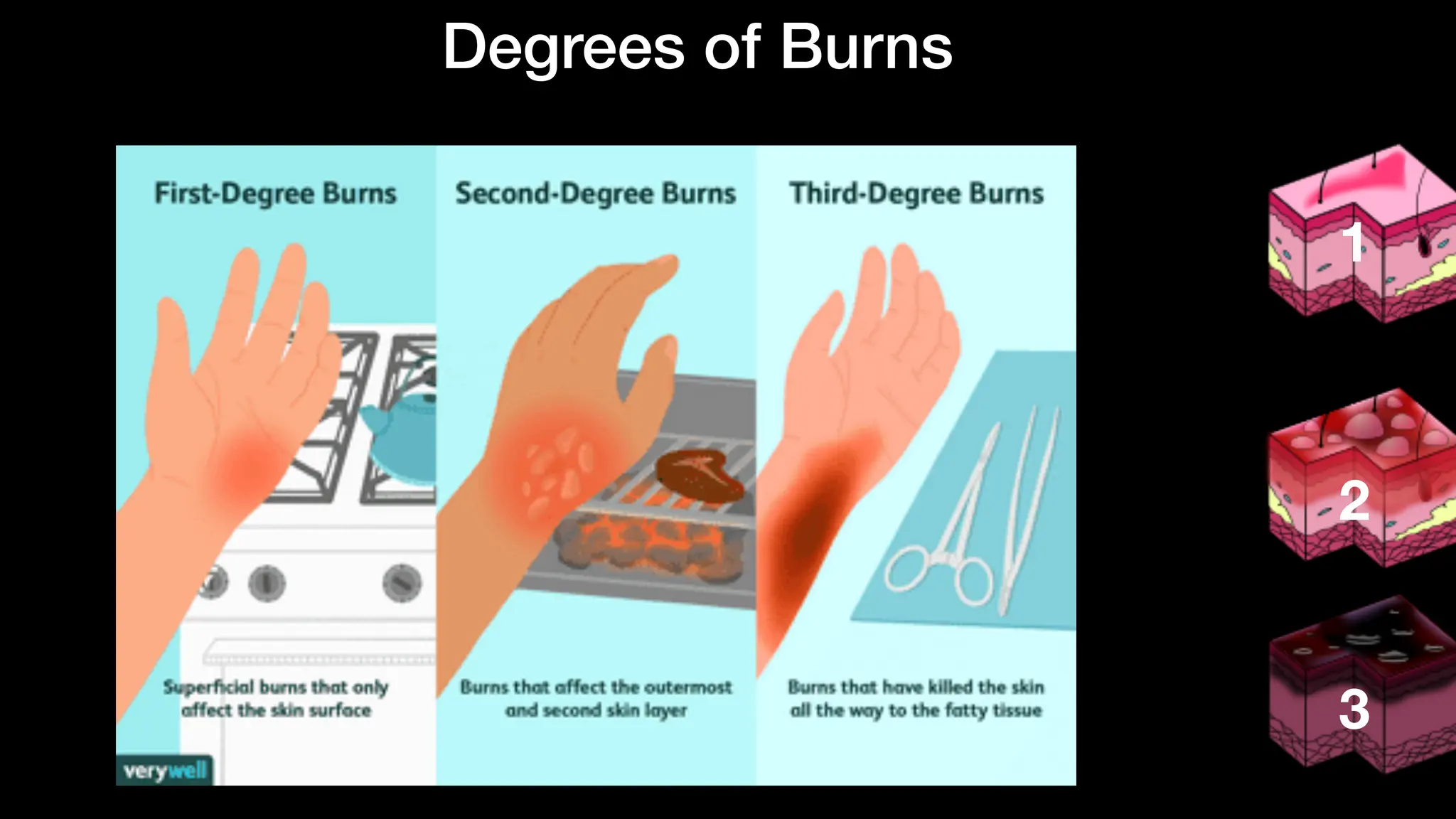 Healthcare-Associated_Burn_Wound_Infections.pdf