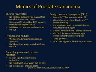 Prostate presentation | PPT