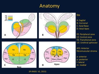 Prostate presentation | PPTX