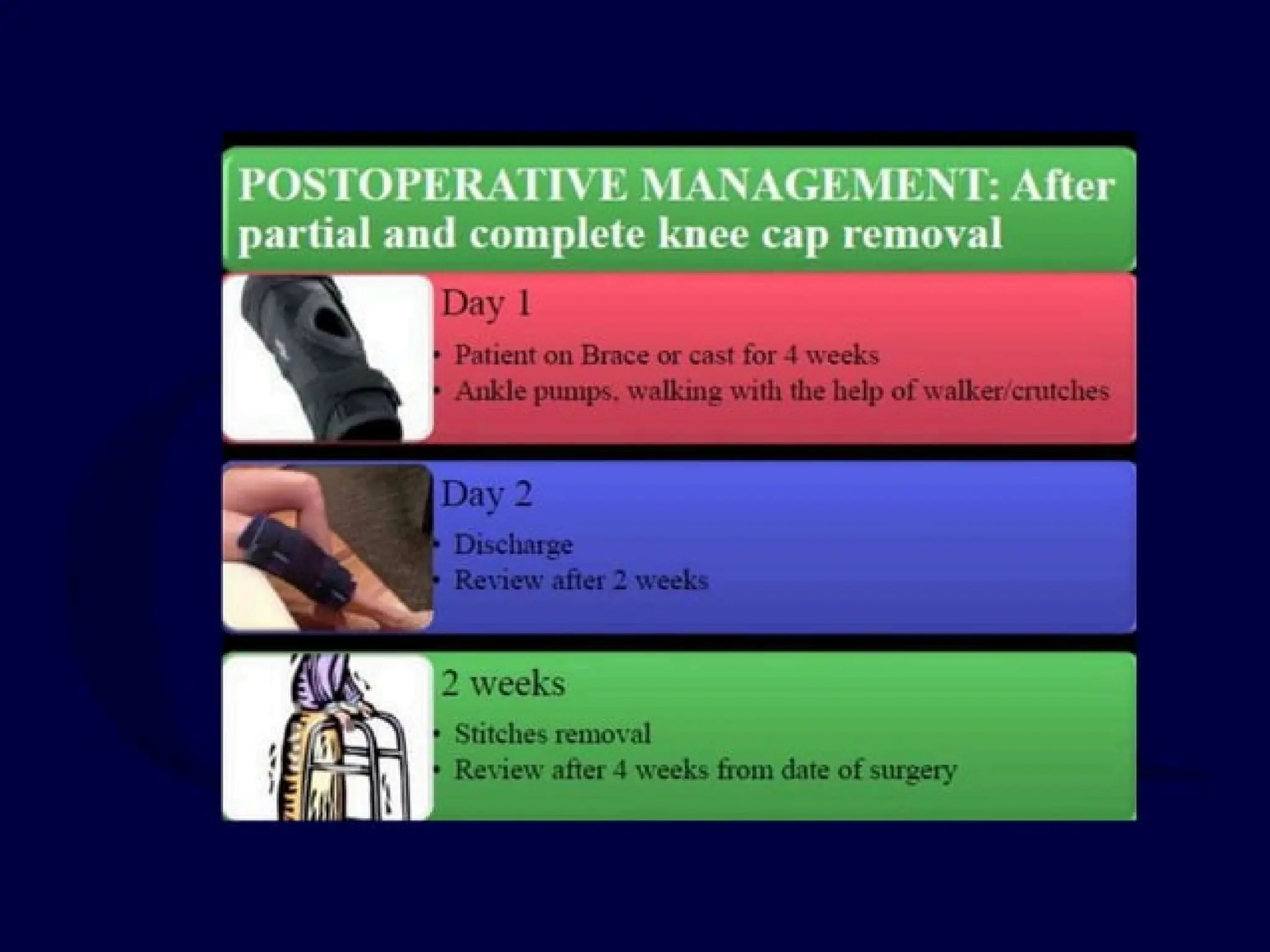 Patella fracture and extensor mechanism in injuries | PDF