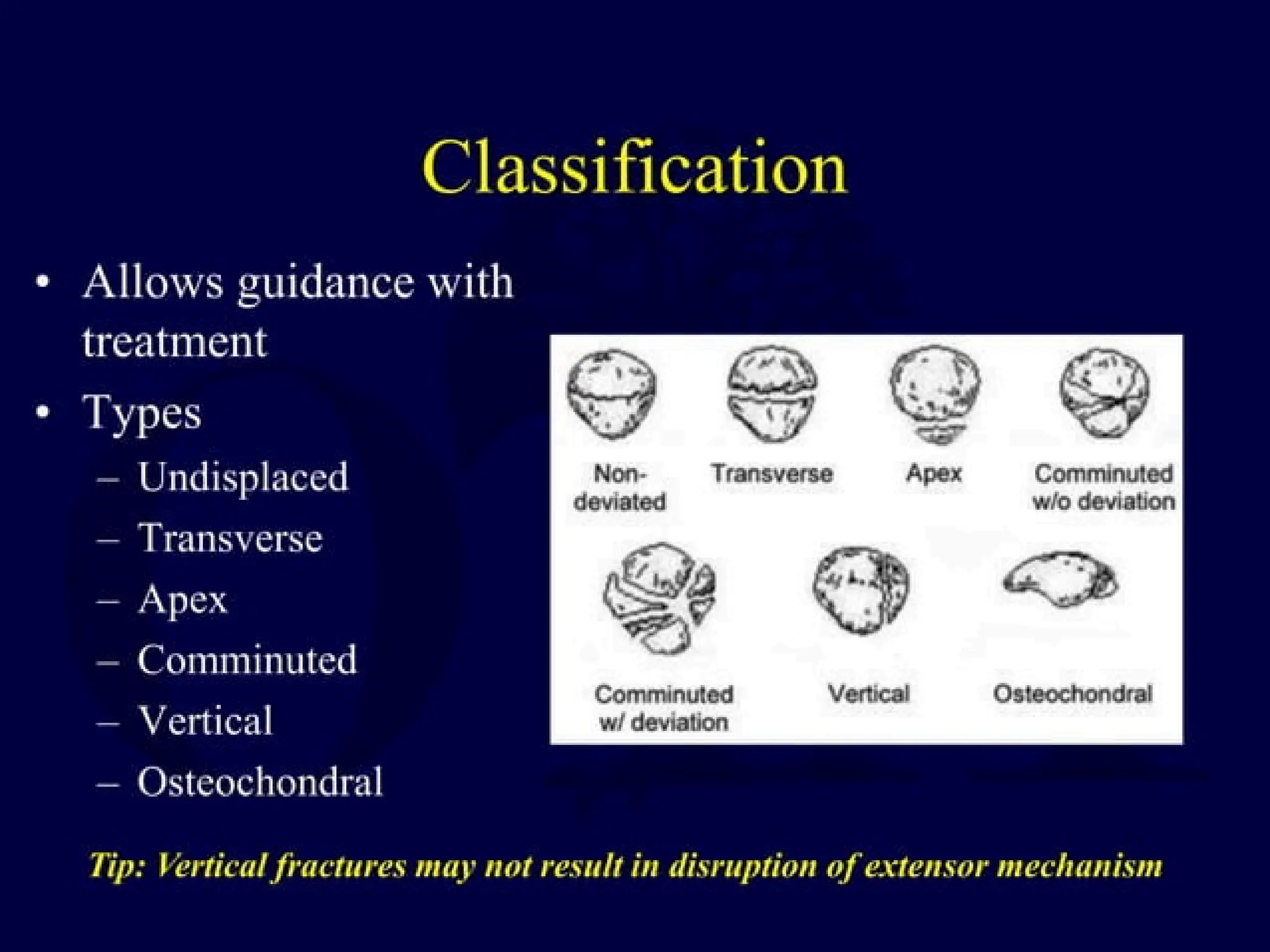 Patella fracture and extensor mechanism in injuries | PDF