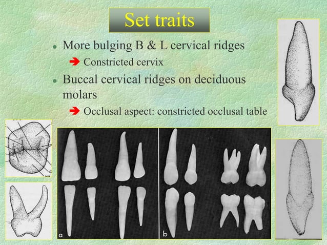 7264369-Morphology-of-Deciduous-Dentition.ppt