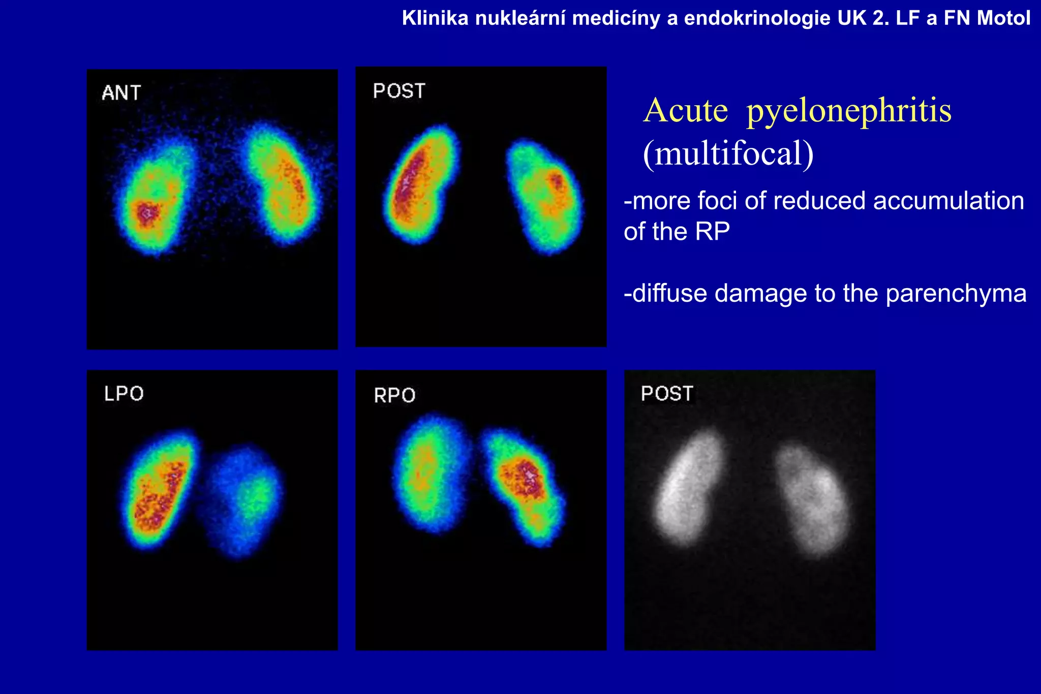 Renal Scan | PPT