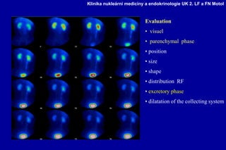 Renal Scan | PPT