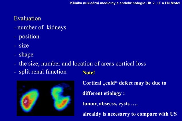 Renal Scan | PPT