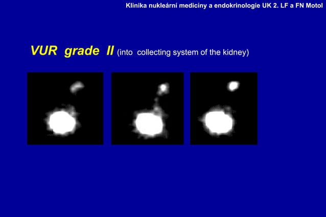 Renal Scan | PPT