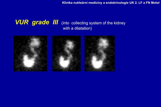 Renal Scan | PPT