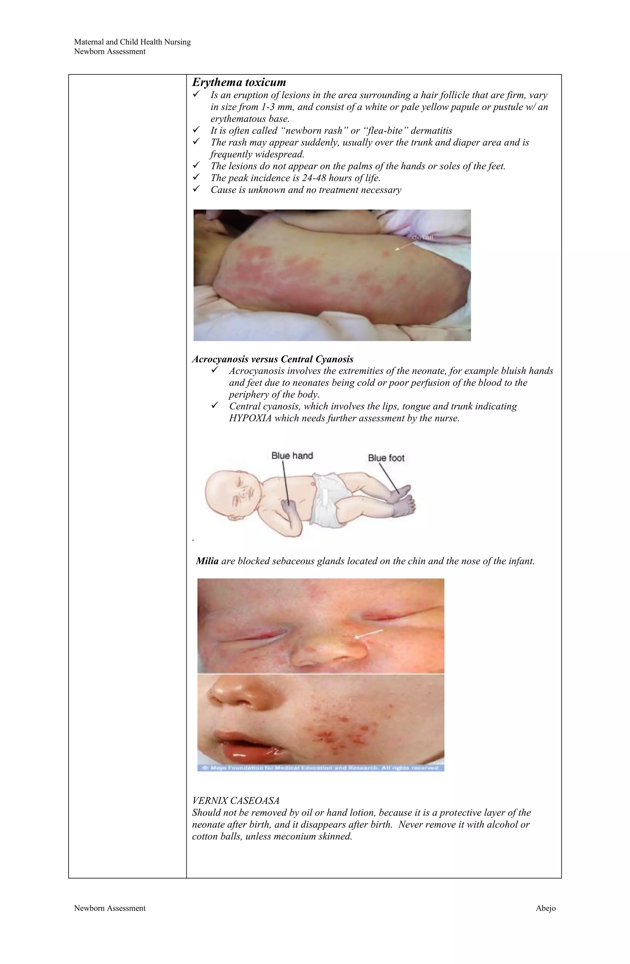 Newborn Assessment | PDF