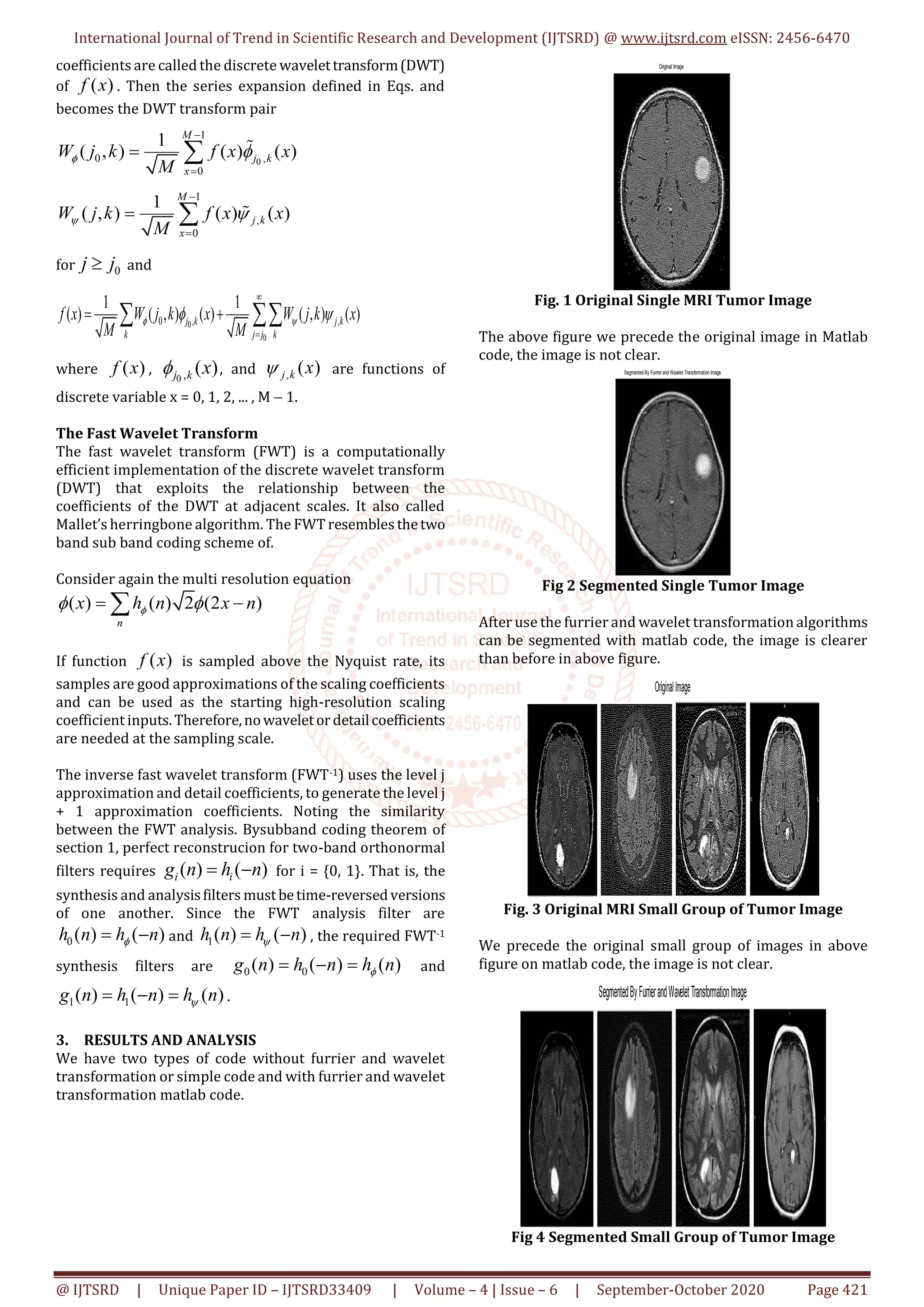 Hybrid Approach For Brain Tumour Detection In Image Segmentation Pdf