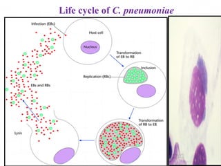 Pneumonia disease- Explanation about the disease and causes | PPTX