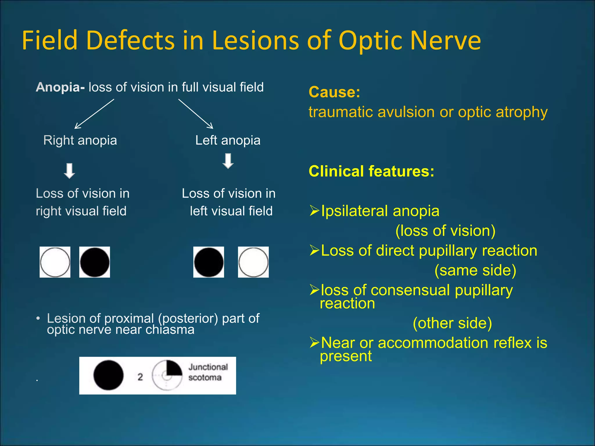734_Visual_Pathway_lesions.pptx