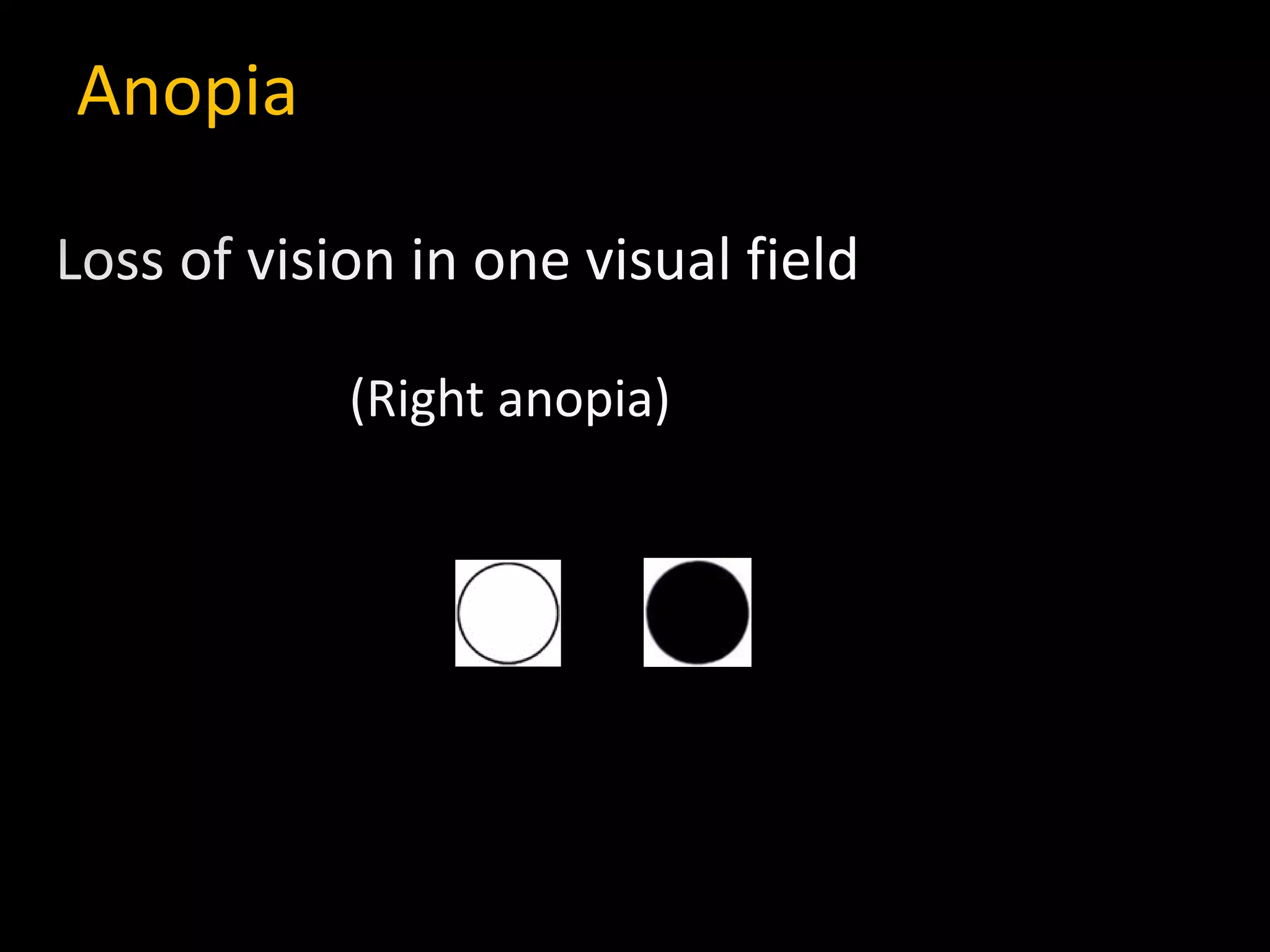 734_Visual_Pathway_lesions.pptx