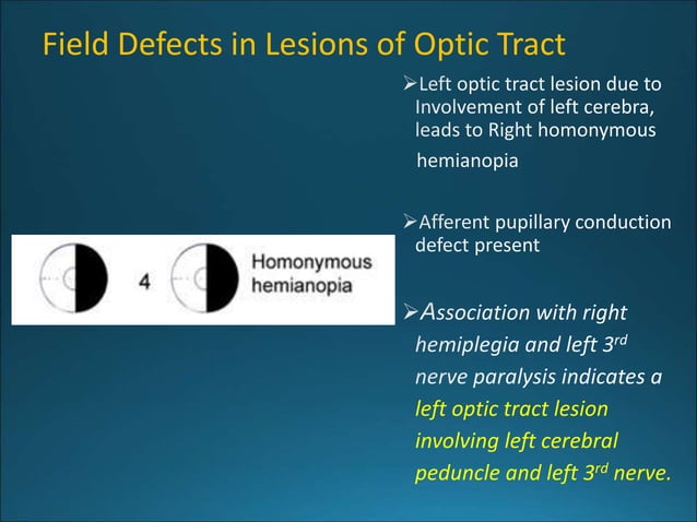 734_Visual_Pathway_lesions.pptx