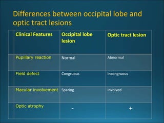 734_Visual_Pathway_lesions.pptx