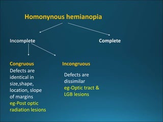 734_Visual_Pathway_lesions.pptx