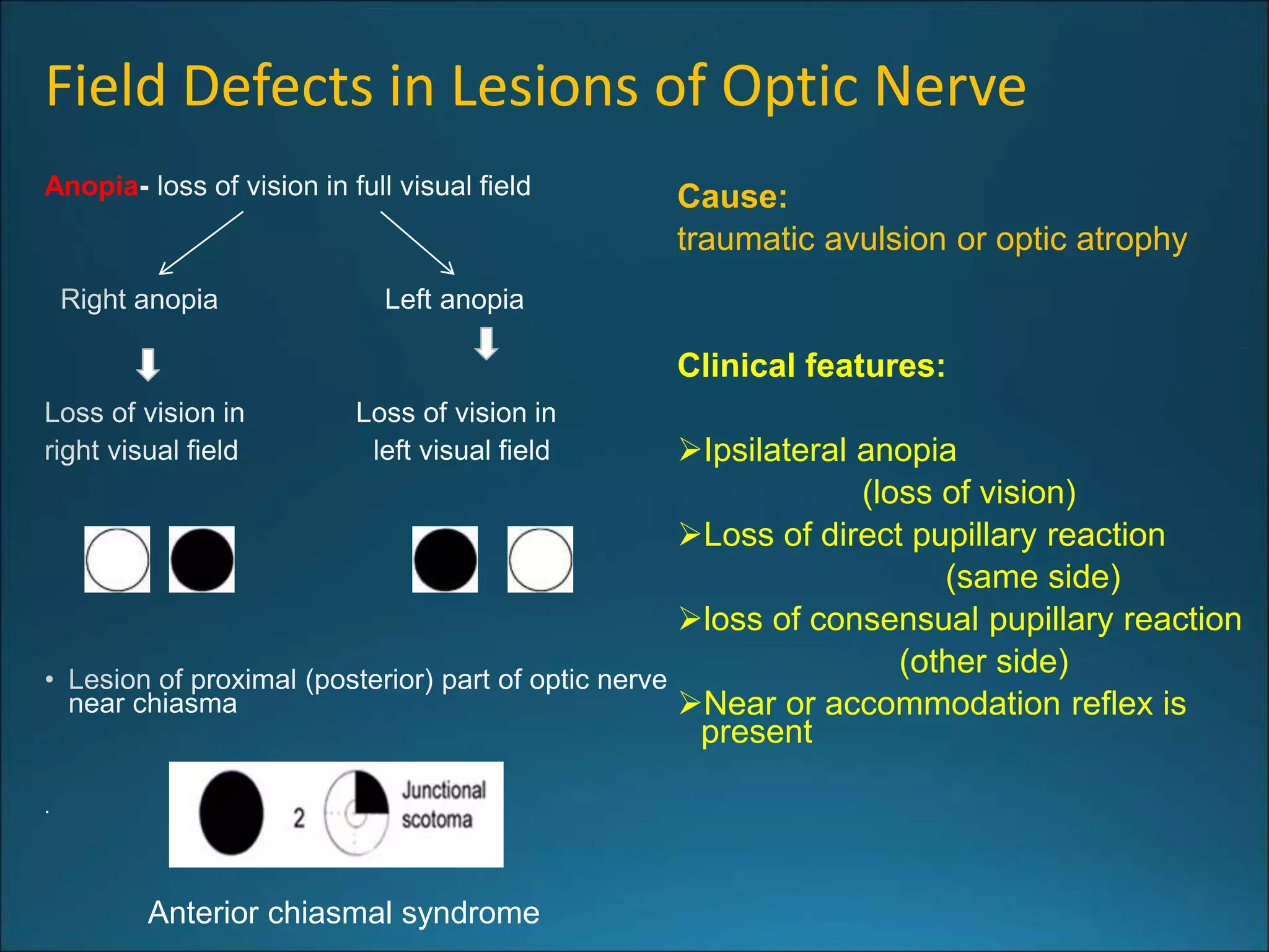 734_Visual_Pathway_lesions.pptx