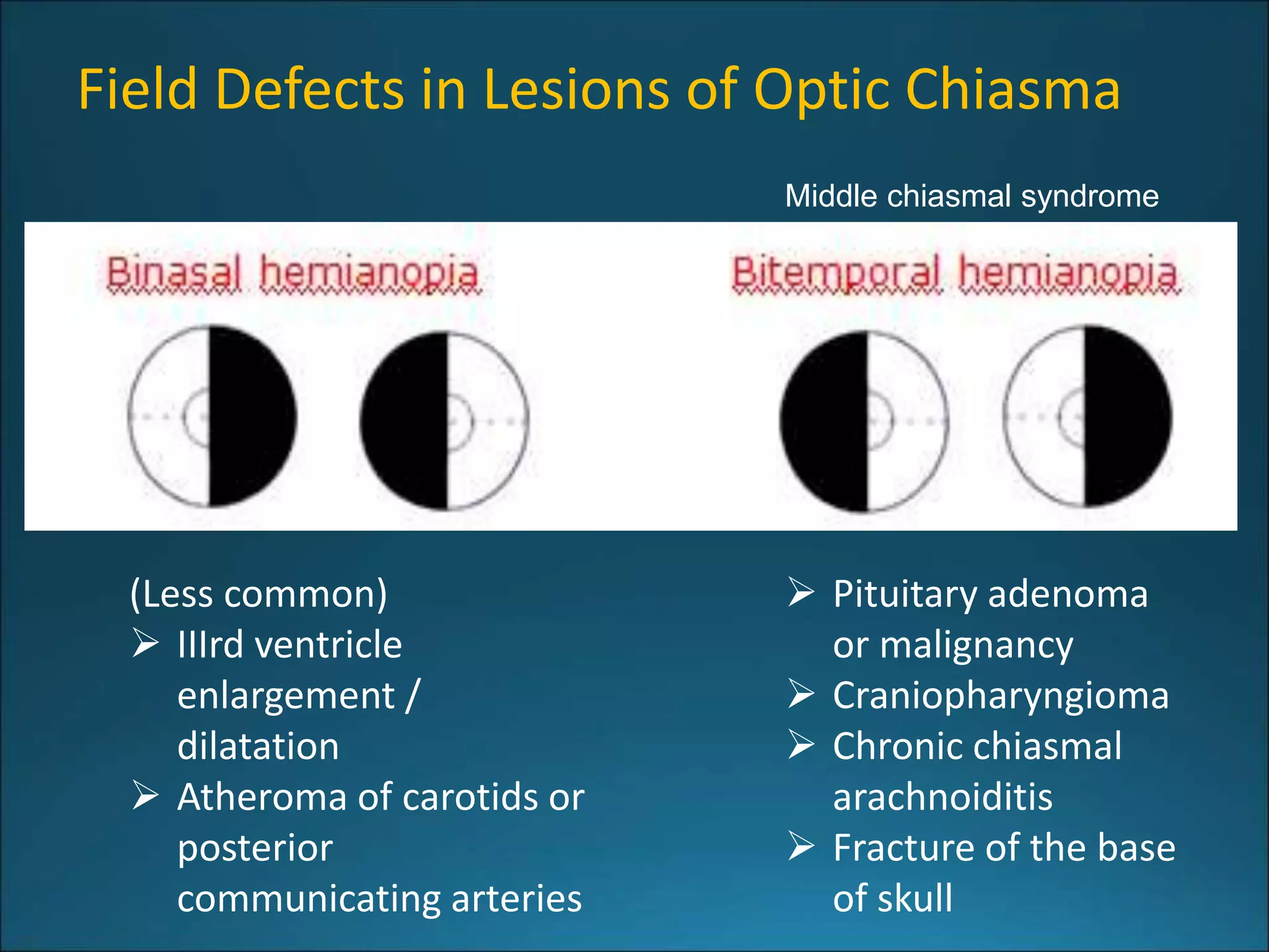 734_Visual_Pathway_lesions.pptx