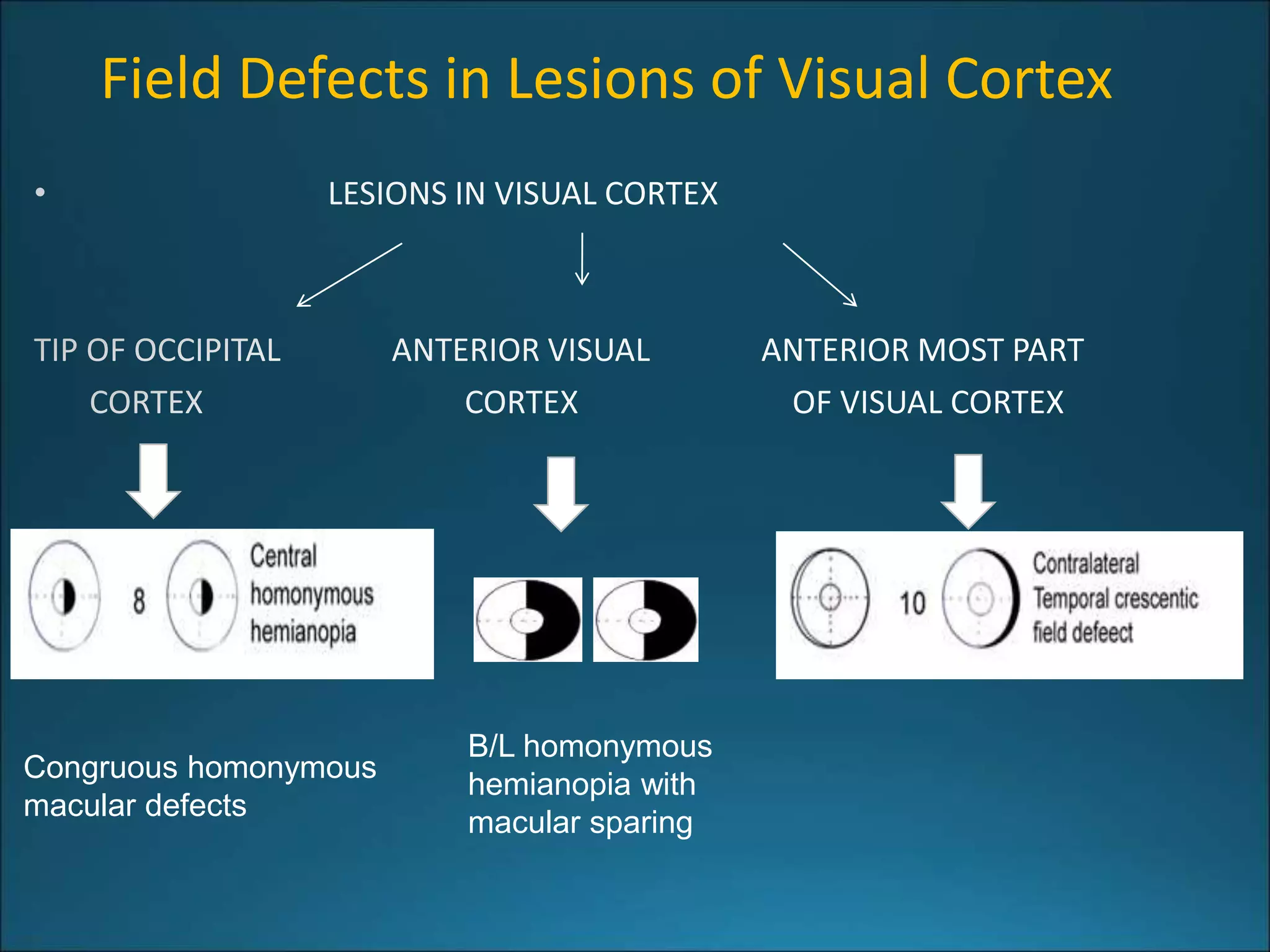 734_Visual_Pathway_lesions.pptx