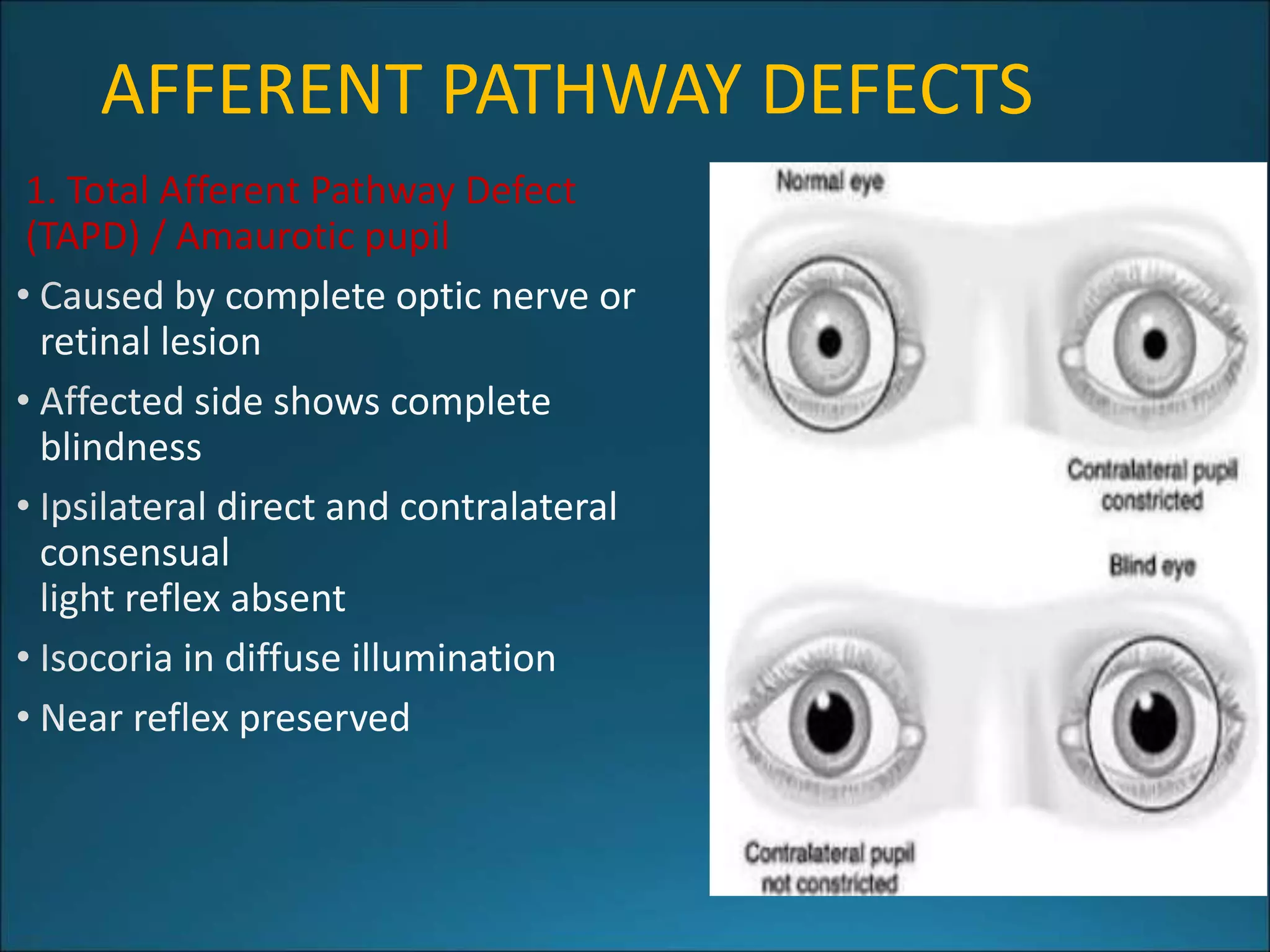734_Visual_Pathway_lesions.pptx
