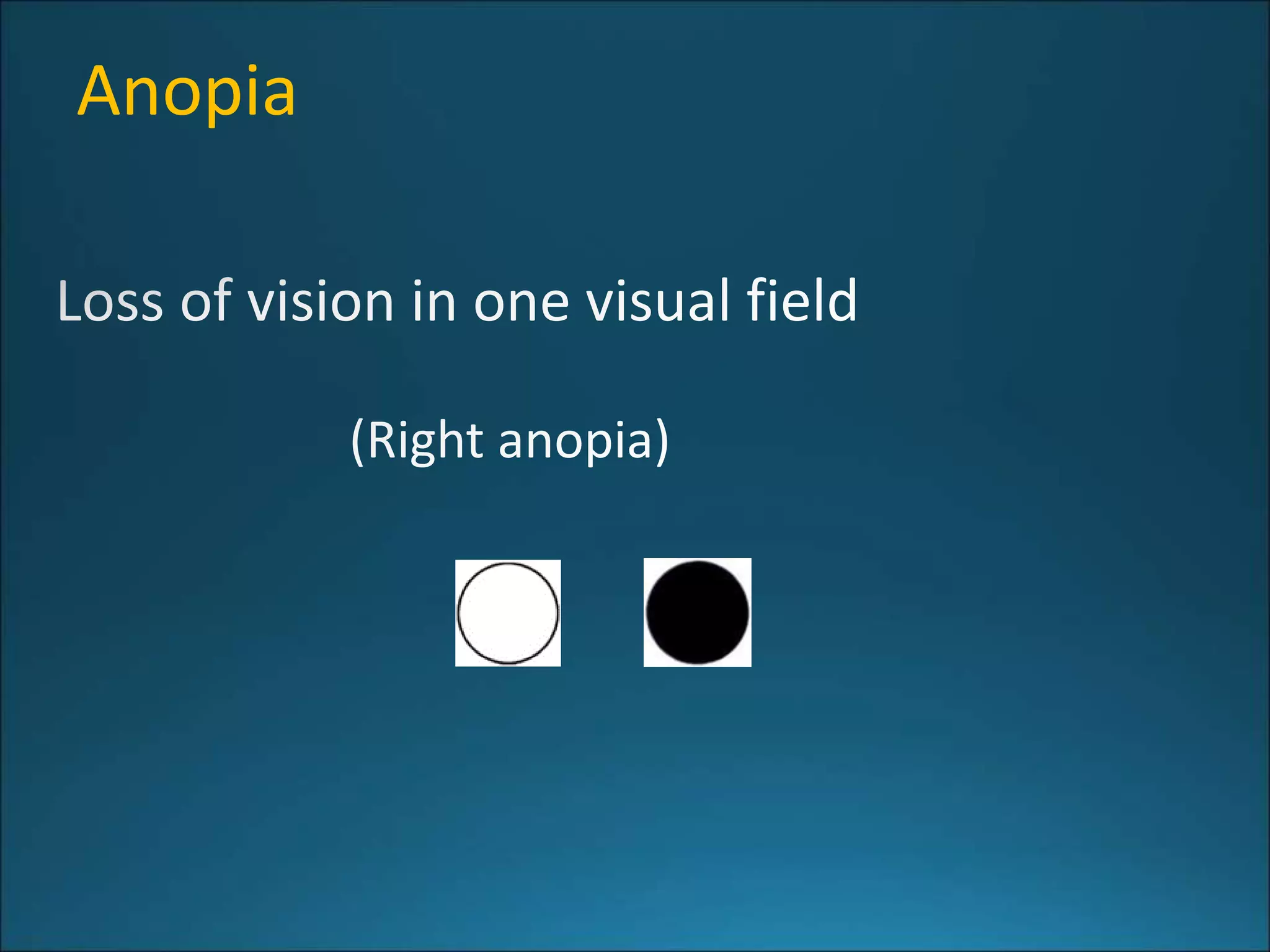 734_Visual_Pathway_lesions.pptx