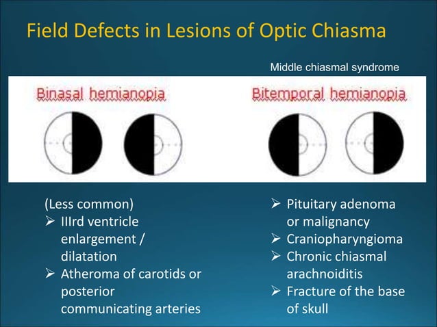 734_Visual_Pathway_lesions.pptx