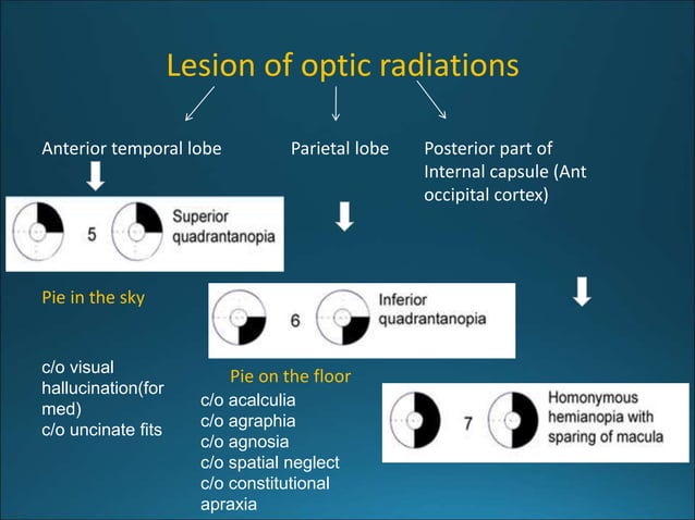 734_Visual_Pathway_lesions.pptx