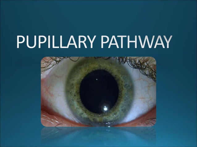 734_Visual_Pathway_lesions.pptx