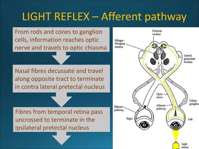 734_Visual_Pathway_lesions.pptx