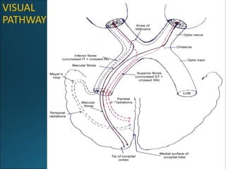 734_Visual_Pathway_lesions.pptx