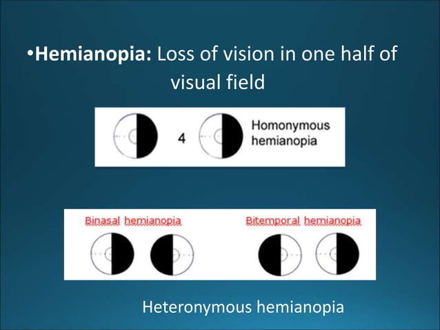 734_Visual_Pathway_lesions.pptx