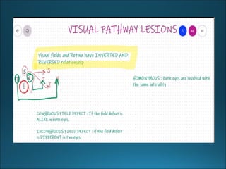 734_Visual_Pathway_lesions AND ANATOMY.ppt